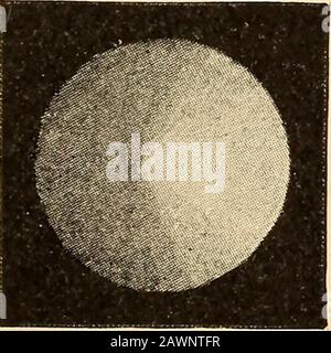 Skiascopy and its practical application to the study of refraction ...