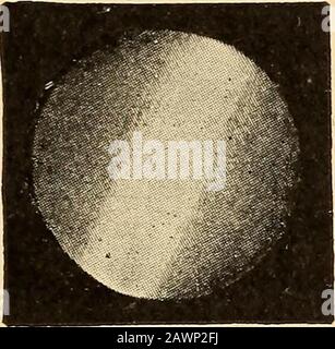 Skiascopy and its practical application to the study of refraction ...