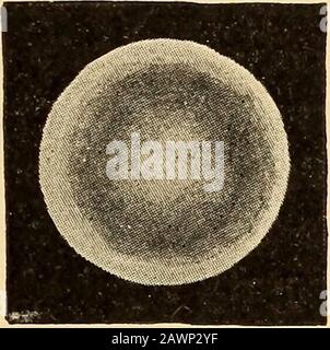 Skiascopy and its practical application to the study of refraction ...