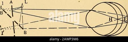 Skiascopy and its practical application to the study of refraction ...