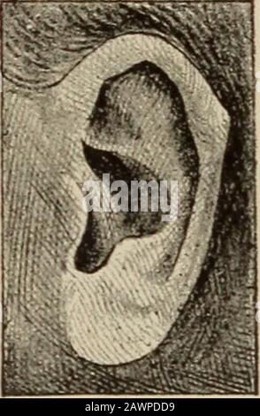 Nervous and mental diseases . Fig. 291.—stahl ear, No. 1. Fig. 292 ...