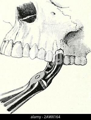 Surgical therapeutics and operative technique . 0). of teeth at one ...