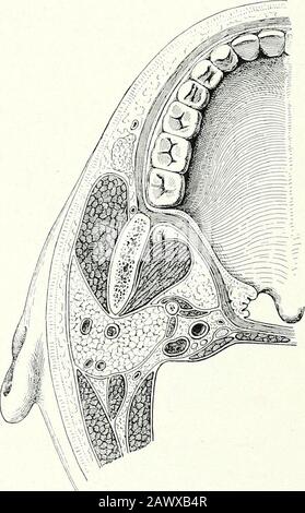 Surgical therapeutics and operative technique . e Vertical Section Fig ...