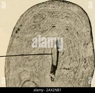 The pathology and surgical treatment of tumors . p-tion than are the ...