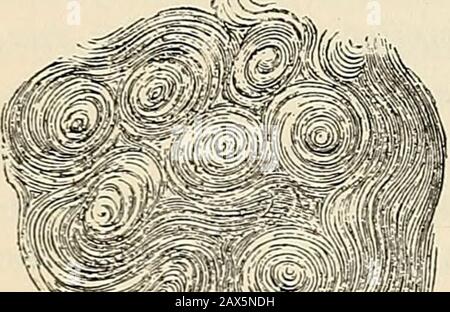 The pathology and surgical treatment of tumors . I. Keloid of external ...