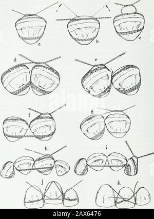 Methods of Teeth Correction Stock Photo - Alamy