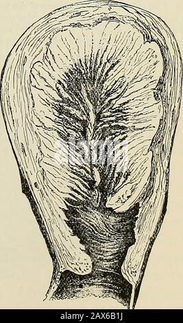 The pathology and surgical treatment of tumors . f the body, is its ...