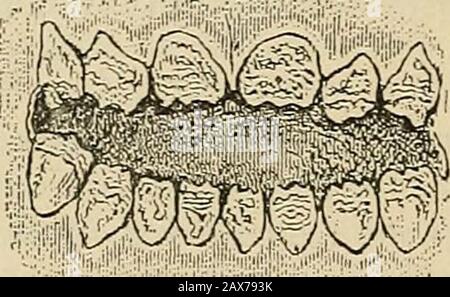 Surgery; its theory and practice . the teeth so affected showing ...