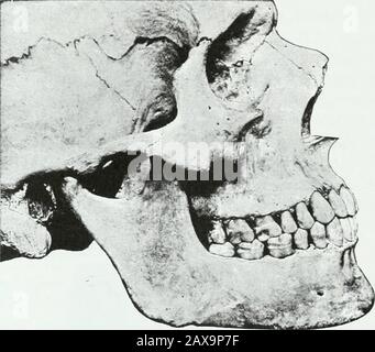 A photograph showing the teeth in the lower jaw of a monkfish, or ...