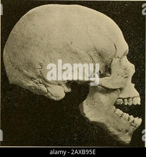 Applied anatomy and oral surgery for dental students . fa BONES 31. 32 ...