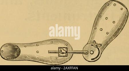 mason's splint for excision of the elbow, medical equipment, surgical ...