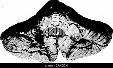 Inferior surface of the cerebellum Stock Photo - Alamy