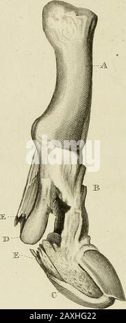 . A treatise on dislocations and fractures of the joints. dislocated by ...