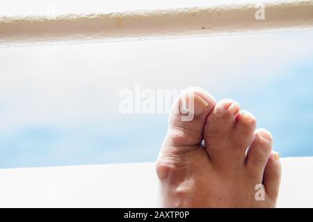 Human foot with conjoined toes Stock Photo - Alamy
