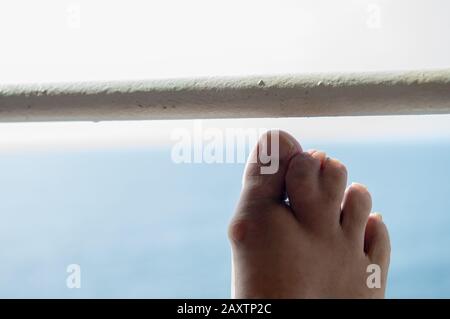 Human foot with conjoined toes Stock Photo - Alamy