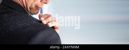 Close-up Of A Businessman's Hand Brushing Off Fallen Dandruff On ...