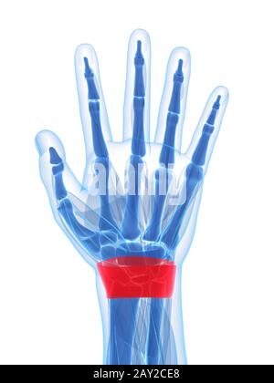 3d rendered illustration of the extensor retinaculum Stock Photo - Alamy