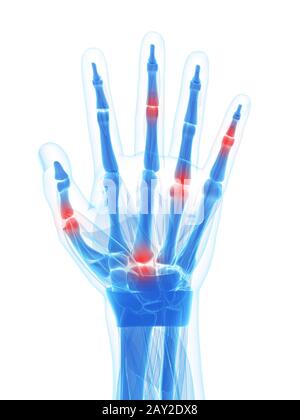 Anatomical Illustration of Tarsal Joints Stock Photo - Alamy