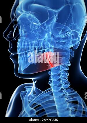 medical illustration of a broken jaw bone Stock Photo - Alamy