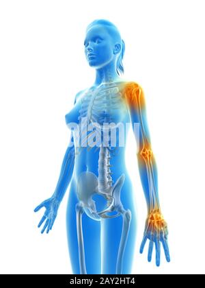 Painful upper spine, illustration Stock Photo - Alamy