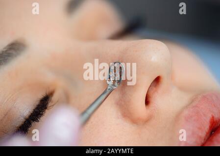 Mechanical cleaning of the face around the nose patient spa salon using ...