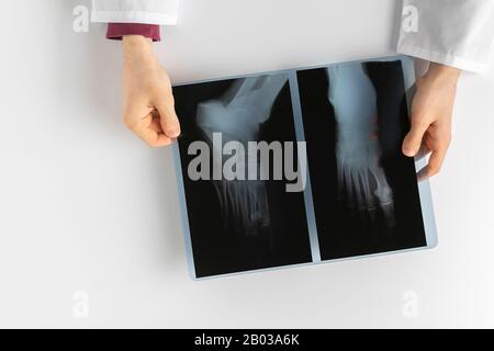 the doctor hands holdong the human body xray scan and examine the bones ...