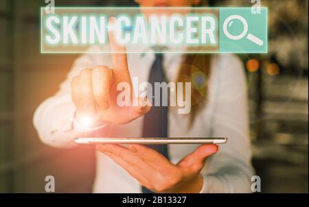 Text sign showing Skin Cancer. Business photo showcasing uncontrolled ...