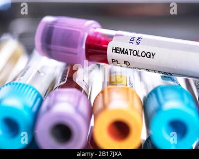 Blood samples awaiting screening in a haematology laboratory. The ...
