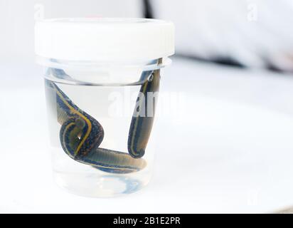 Hirudotherapy procedure, hirudotherapy, leeches as therapy, prevention ...