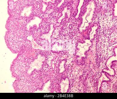 Endometrial glands in secretory phase, light micrograph. During the ...