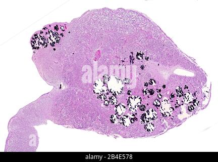 Light micrograph of a sagittal section of a human pineal gland. The ...