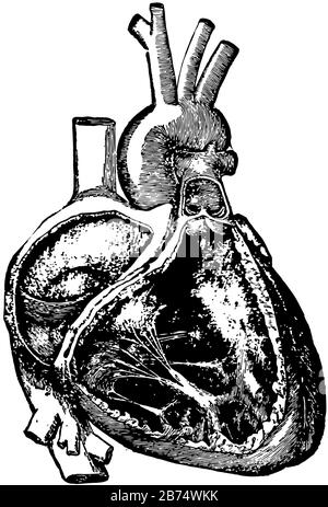 This diagram represents a Right Side of Heart, vintage line drawing or ...