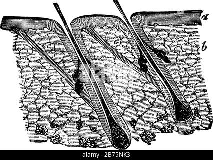 This illustration represents Section of skin, vintage line drawing or ...