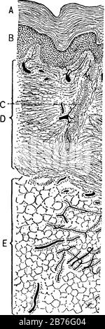 This illustration represents Section of skin, vintage line drawing or ...