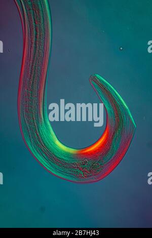 Oxiuris parasitic pinworm 100x under the microskope Stock Photo - Alamy