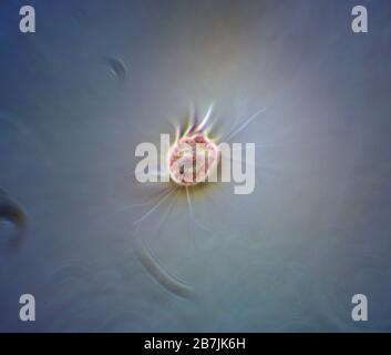 Freshwater ciliate from pond water, Halteria sp. Darkfield ...