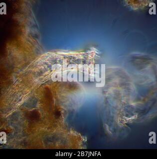 Darkfield photomicrograph, bdelloid rotifer, Philodina rotifer feeding ...