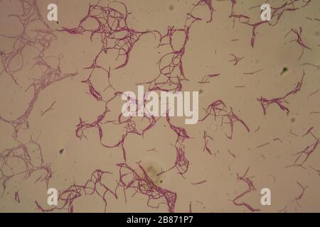 Bacillus anthracis anthrax under the microscope 200x Stock Photo - Alamy