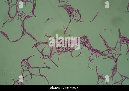 Bacillus anthracis anthrax under the microscope 200x Stock Photo - Alamy