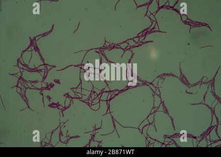 Bacillus anthracis anthrax under the microscope 200x Stock Photo - Alamy