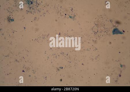 Tuberculosis bacteria under the microscope 400x Stock Photo - Alamy