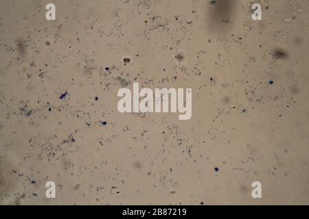 Tuberculosis bacteria under the microscope 400x Stock Photo - Alamy