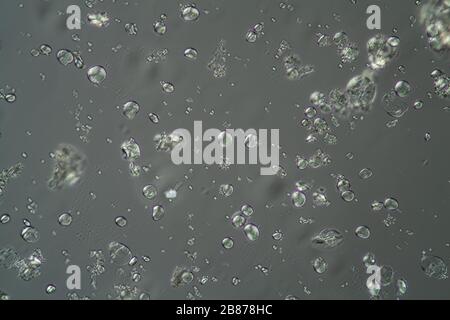Cereal starch grains under the microscope 200x Stock Photo - Alamy