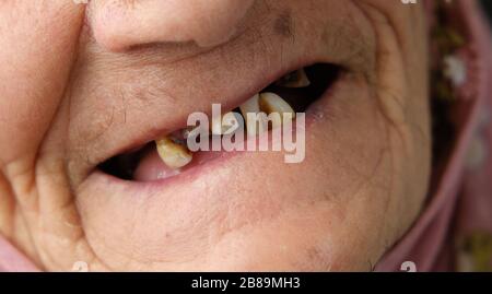 old woman without teeth, old woman with a few teeth in her mouth Stock ...