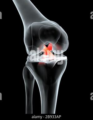 Accurate medically illustration showing knee joint with ligaments ...