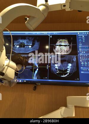 Three Dimensional Cone-Beam X-Ray Machine Stock Photo - Alamy