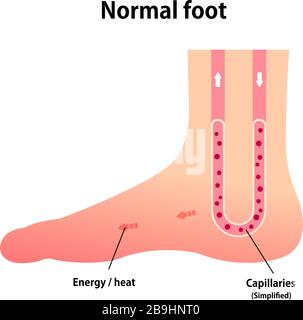 Cold foot blood circulation illustration (sensitivity to cold, cold ...