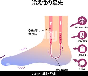 Cold foot blood circulation illustration (sensitivity to cold, cold ...