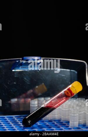 Each blood vial is transported to the laboratory for specialized tests ...