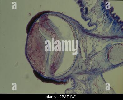 Eyeball in longitudinal section under the microscope 50x Stock Photo ...